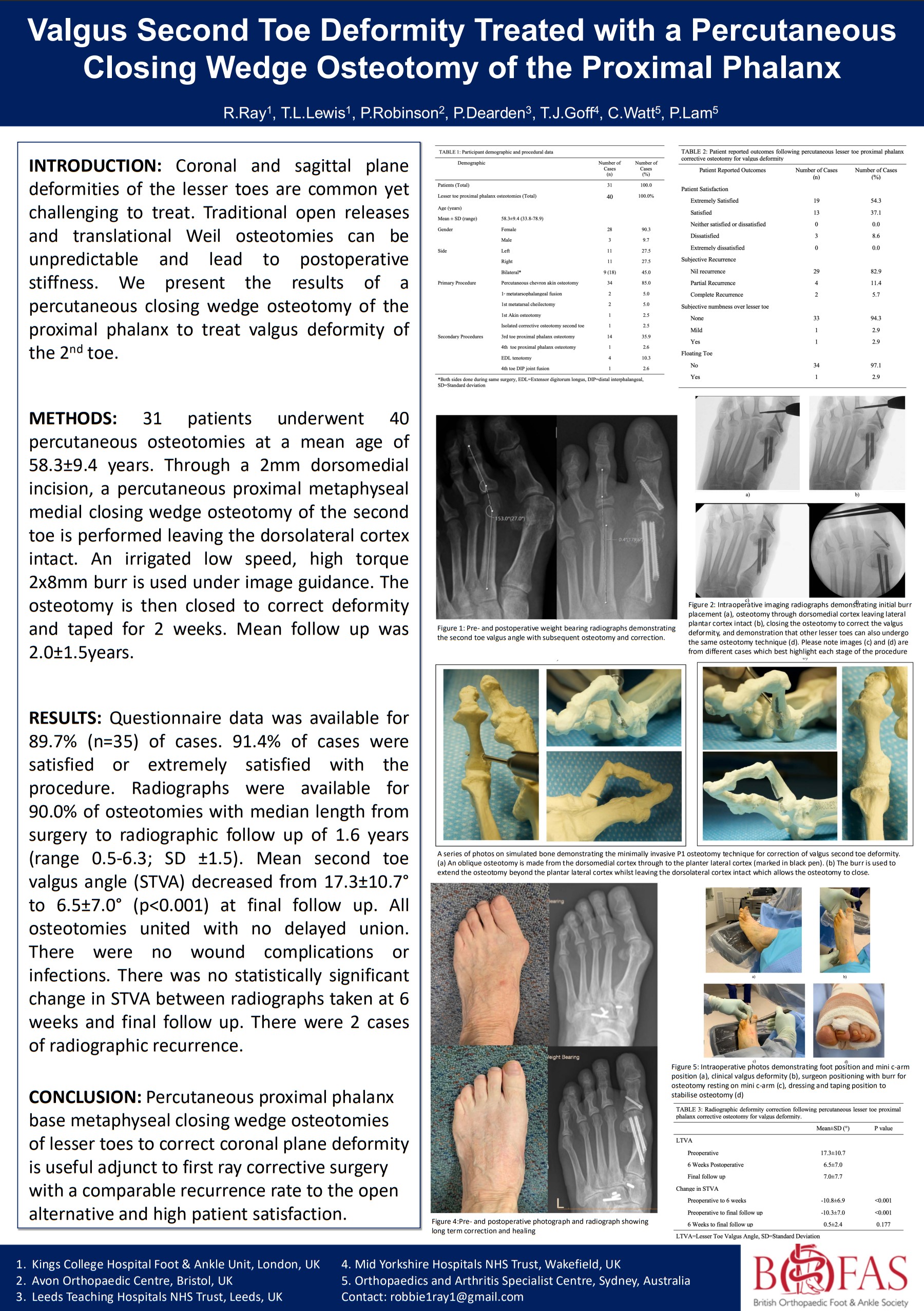 Correction of valgus lesser toe deformity using a closing wedge ...