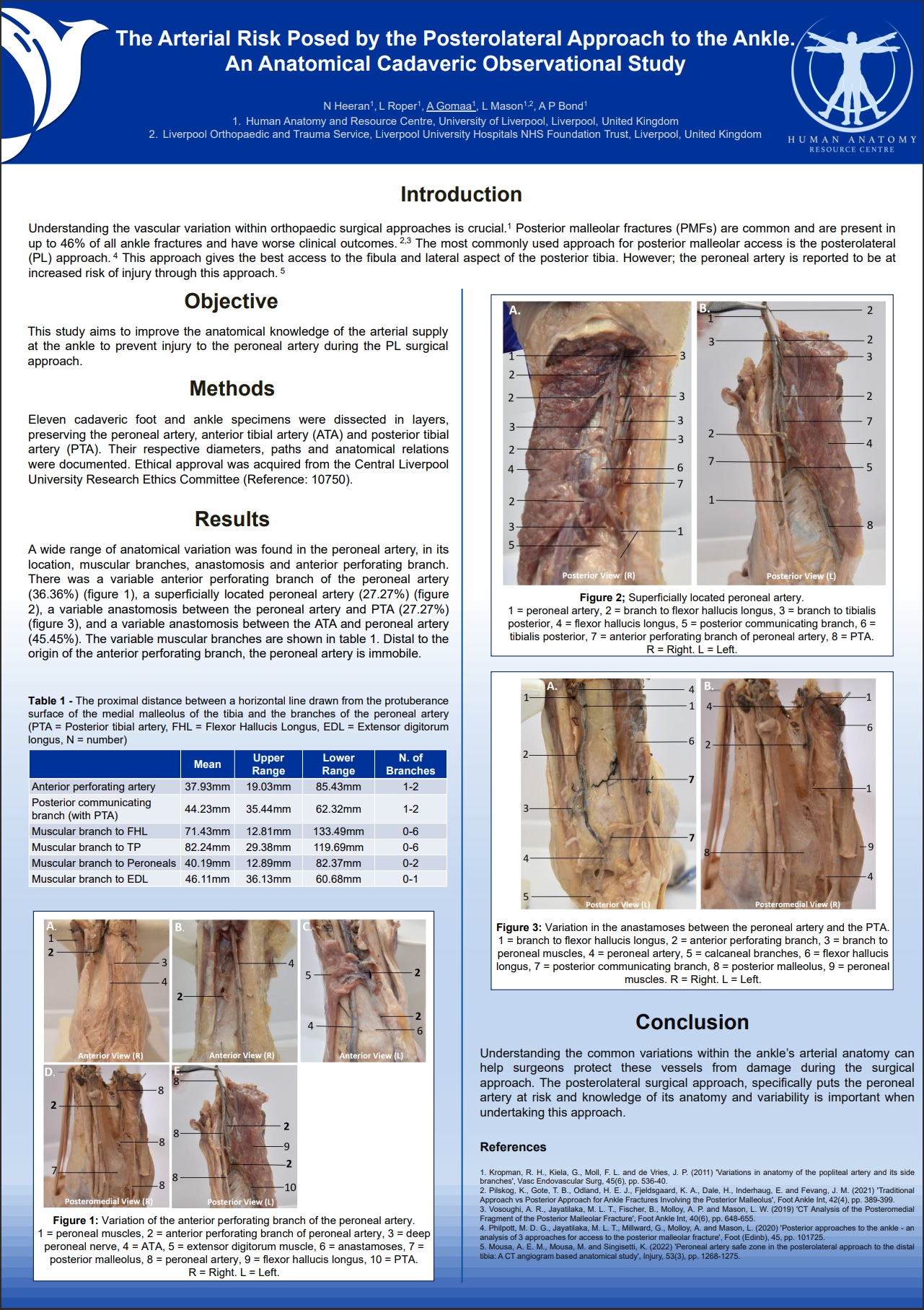 The arterial risk posed by the posterolateral approach to the ankle. An ...