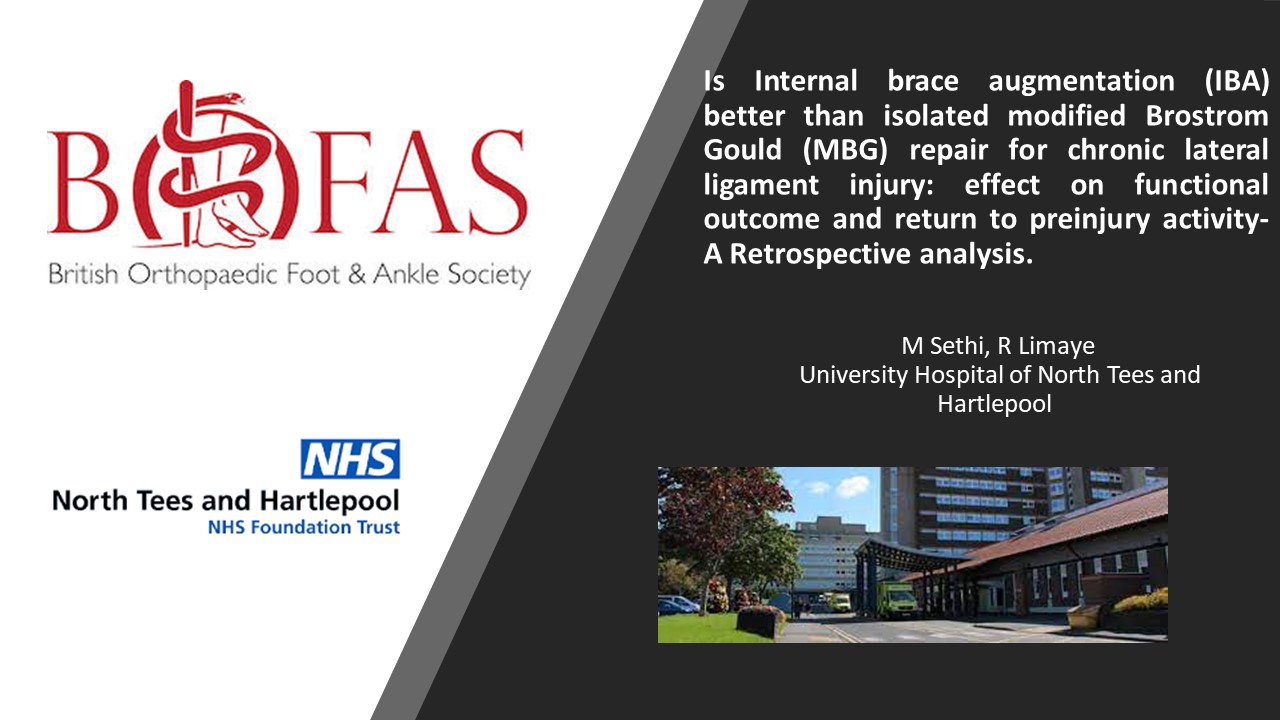 Is Internal Brace Augmentation (IBA) better than isolated Modified ...