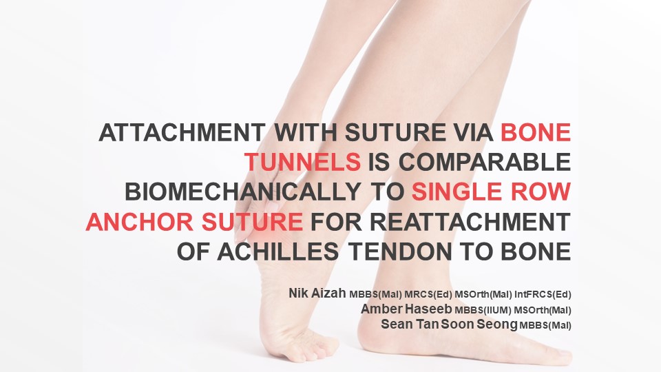 Attachment with suture via bone tunnels is comparable biomechanically ...