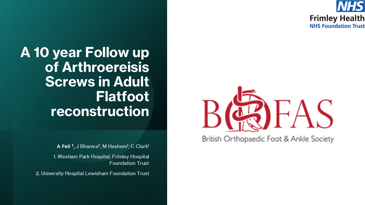 A 10-year follow up of Arthroereisis screws in Adult Flat Foot ...