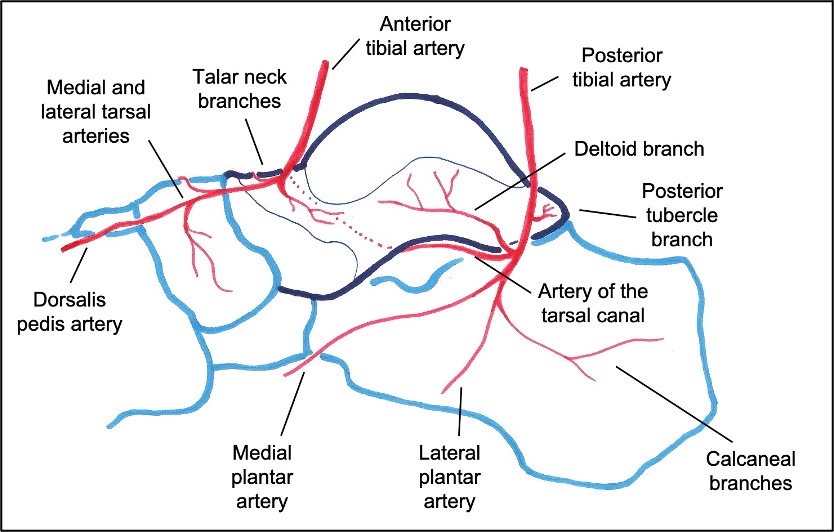 BOFAS > Hyperbook > Trauma > Talus Fractures > Talar Neck / Body Fracture