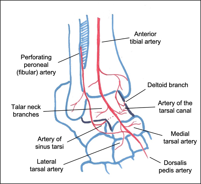 BOFAS > Hyperbook > Trauma > Talus Fractures > Talar Neck / Body Fracture