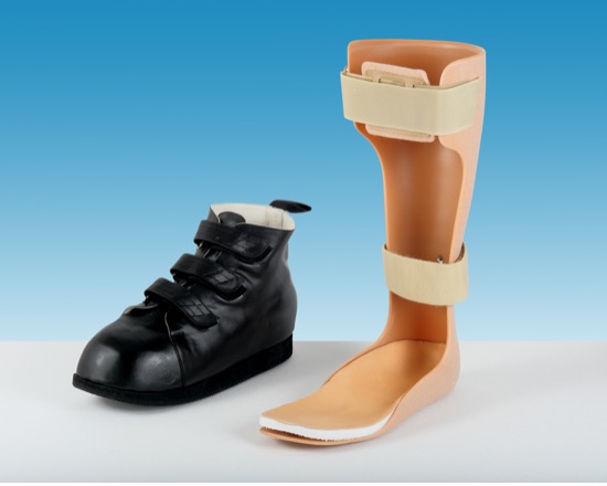 BOFAS > Hyperbook > Miscellaneous > Amputations