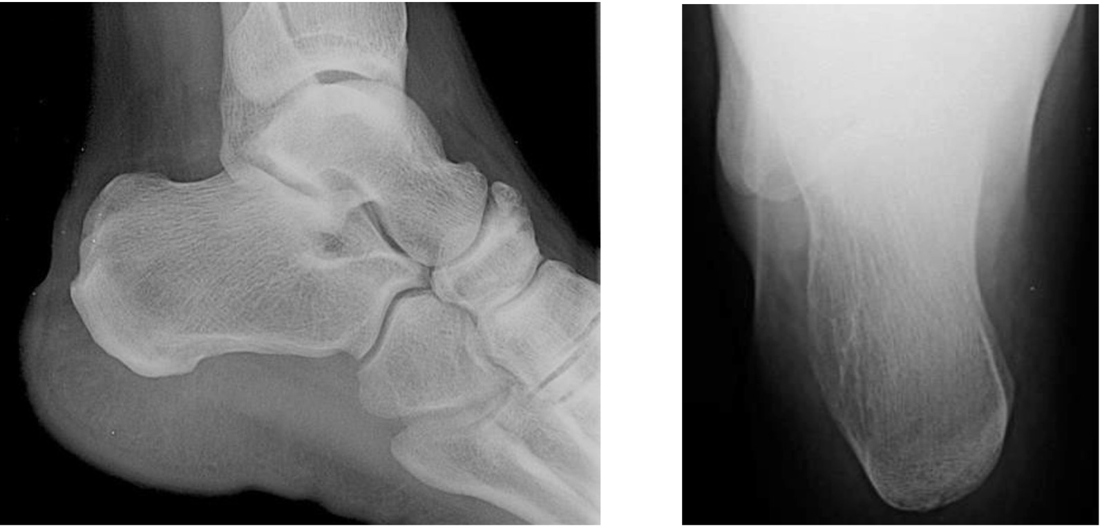 BOFAS > Hyperbook > Radiology > 1. Radiographic Views