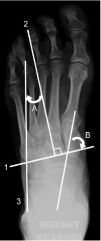BOFAS > Hyperbook > Radiology > 2. Alignment