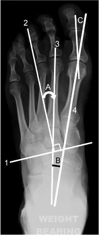 BOFAS > Hyperbook > Radiology > 2. Alignment