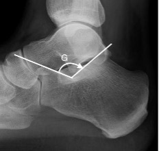 BOFAS > Hyperbook > Radiology > 2. Alignment