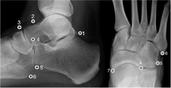 BOFAS > Hyperbook > Radiology > 3. Anatomical Variation