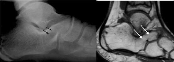BOFAS > Hyperbook > Radiology > 3. Anatomical Variation