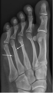 BOFAS > Hyperbook > Radiology > 8. Joint and Soft Tissue Pathology